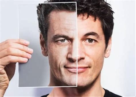 التجاعيد أسبابها وطرق علاجها علاجك الطبية