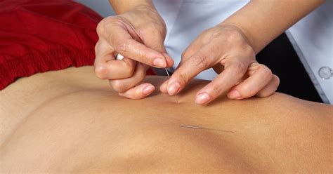 Trigger Point Dry Needling Hoangchiro