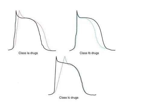 Class I Antiarrhythmic Agents Deranged Physiology