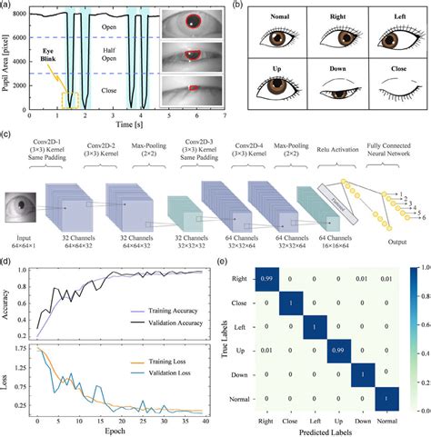 A Relationship Between The Pupil Area And Eye Statuses For Detecting