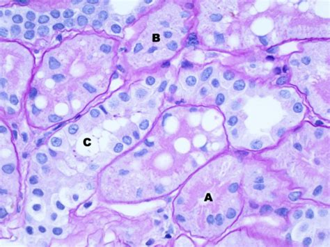 HISTO LAB FINAL EXAM Flashcards Quizlet