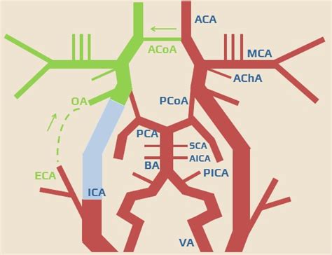 Cerebral Collateral Circulation Stroke Manual
