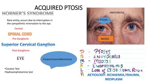 Anatomy Of Eyelid And Ptosis Pptx Eye And Vision Conditions