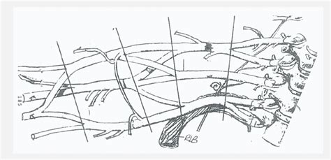Brachial Plexus Diagram Quizlet