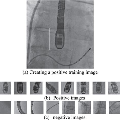 Examples Of Probe Detection And Estimation Of In Plane Parameters The