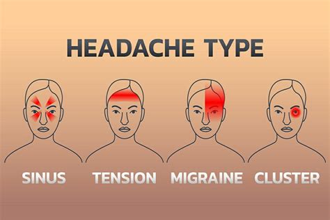 Four Headaches That Reveal What Is Wrong With Your Health Holistic