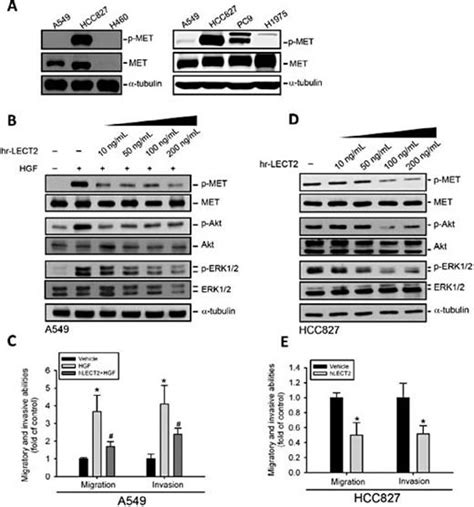 Leukocyte Cell Derived Chemotaxin 2 Retards Non Small Cell Lung Cancer