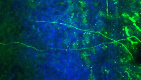 This Week In The Journal Journal Of Neuroscience