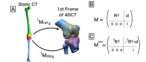Four Dimensional Ct Analysis Using Sequential 3d 3d Registration