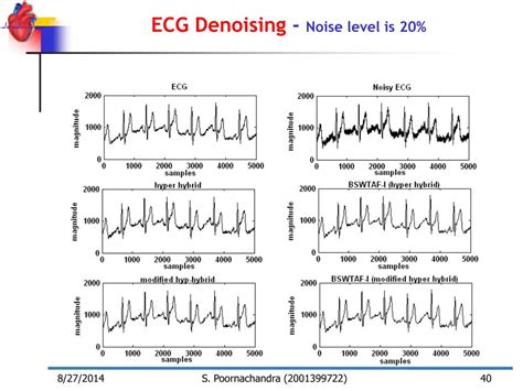 Ppt Wavelet Based Subband Shrinkage Models And Their Applications In