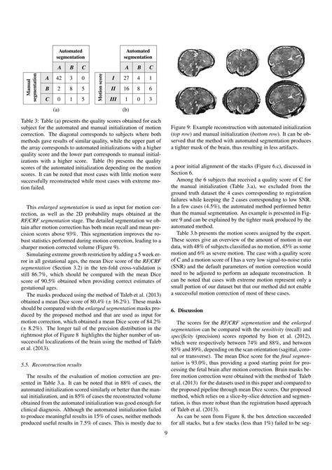 Automated Fetal Brain Segmentation From 2d Mri Slices For Motion Correction Neuroimage 2014