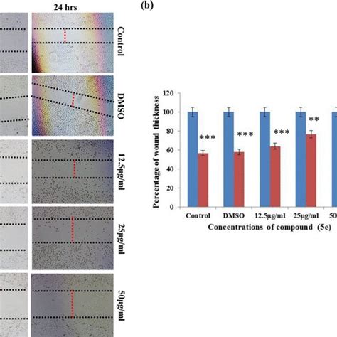 A Wound Healing Assay Showed That 5e Inhibited The Migration Of Hela