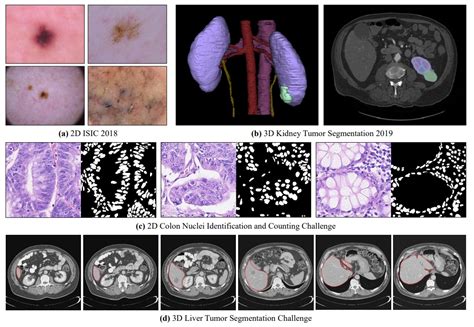 港科大最新《深度学习医学图像分割mediseg》综述论文，21页pdf涵盖212篇文献阐述mediseg技巧、挑战和未来方向 知乎