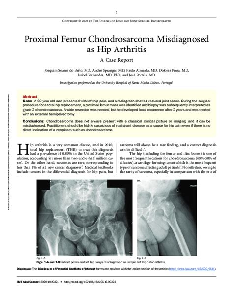 Pdf Proximal Femur Chondrosarcoma Misdiagnosed As Hip Arthritis