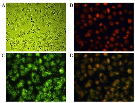 Ldl Lectin Assay To Detect Epcs In Culture A Cultivated Pbmcs Were