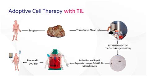 What Is Til Therapy For Metastatic Melanoma Israeli Hospitals Ltd