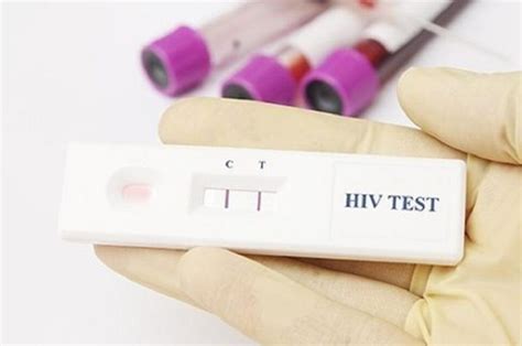 Expansive Growth Forecasted For Hiv Self Test Kits Market As