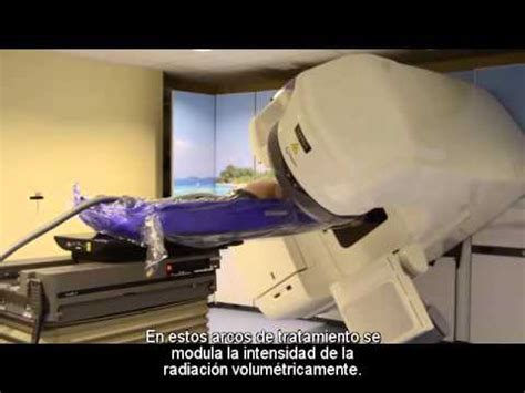 Oncológico 2 0 SBRT Radioterapia Estereotáxica Corporal