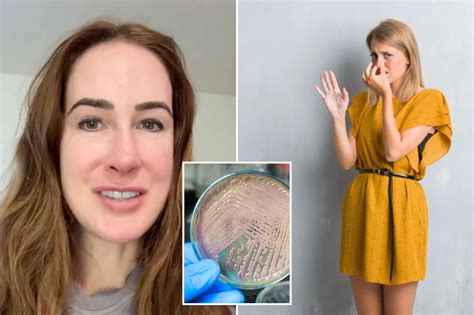 Wearing Contacts Can Cause This Scary Eye Condition Doctor
