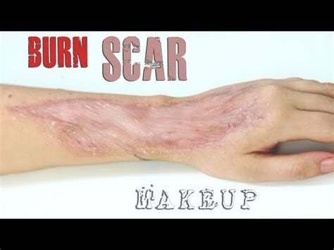 Easy Burn Scar Makeup Saubhaya Makeup