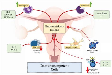 The Main Theories On The Pathogenesis Of Endometriosis