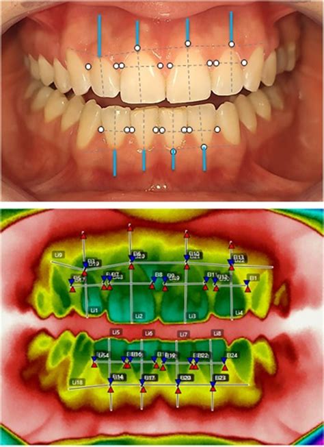 Reference Points Traced On The Photo Clinical And Thermograms Download Scientific Diagram