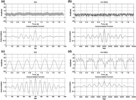 A Eeg Figures Featuring Autocorrelation Diagrams Where The Normal