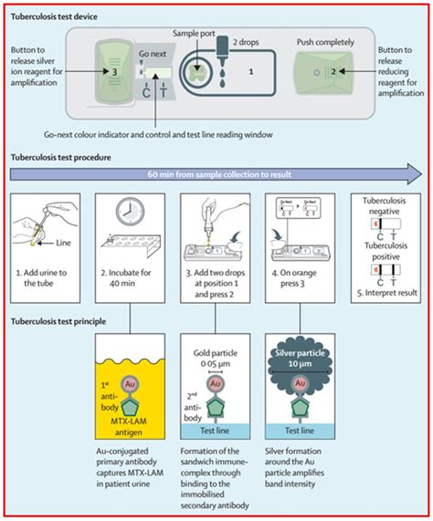 Schematic Representation Of Novel Lipoarabinomannan Poc Device For Download Scientific Diagram