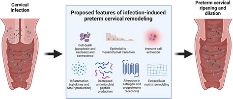 Frontiers Breaking Down The Barrier The Role Of Cervical Infection