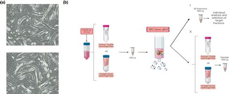 Workflow For Evs Isolation By Size‐exclusion Chromatography A Light
