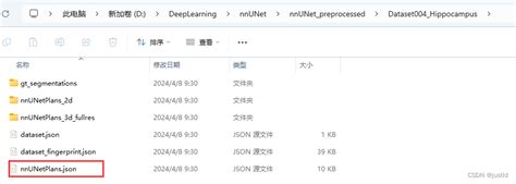 【nnunetv2实践】二、nnunetv2快速入门 训练验证推理集成一条龙教程nnunet 安装 Csdn博客