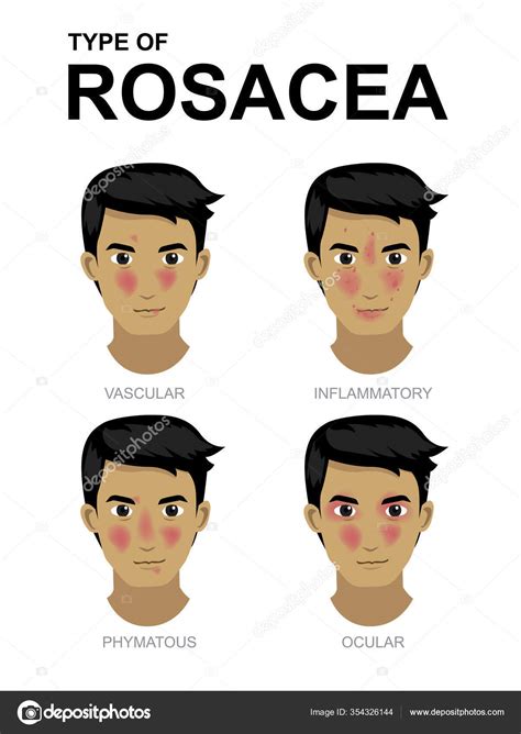 Manga Cartoon Type Rosacea Man Set Stock Vector By ©punnawich 354326144