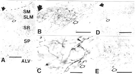 Occipitotemporal Sulcus Semantic Scholar