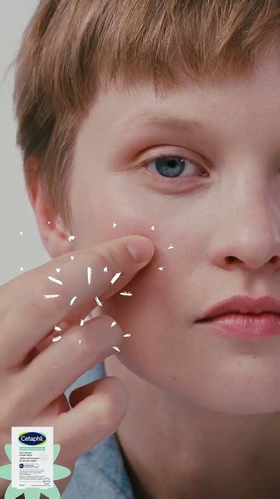 Clear Emerging Pimples With Cetaphils New Fast Rescue Pimple Patch Youtube