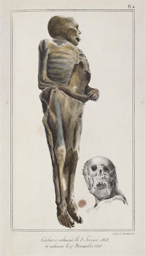 Visible Proofs Forensic Views Of The Body Galleries Exhibition