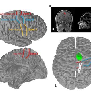 Primary Motor Cortex Of The Brain A Schematic Of Zones 1 3 In The Download Scientific
