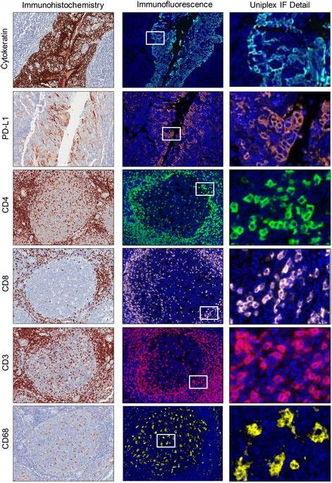 Validation Of Multiplex Immunofluorescence Panels Using Multispectral Microscopy For Immune