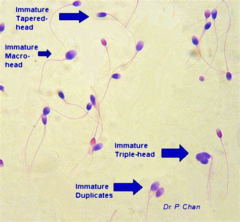 Andrology Lab Loma Linda University Fertility Center