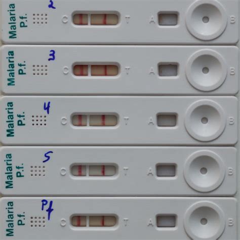 example of buffer substitution s effect on a three band rdt three band