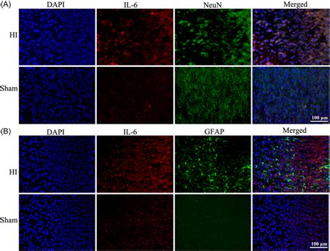 Location Of Interleukin Il ‐6 In The Neuron And Astrocytes After Hi