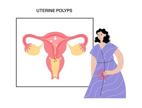 100000 Hysteroscopy Vector Images Depositphotos
