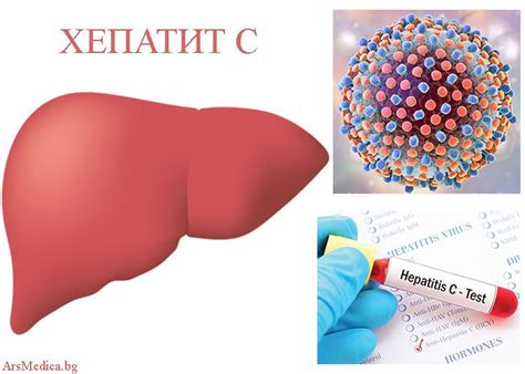 Повишена урея Arsmedica Bg