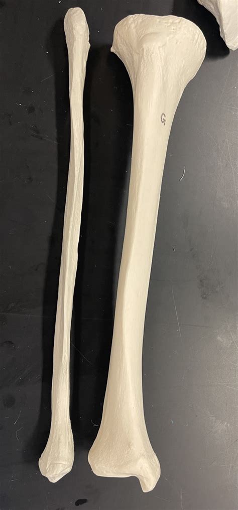 Right Tibia And Fibula Diagram Quizlet