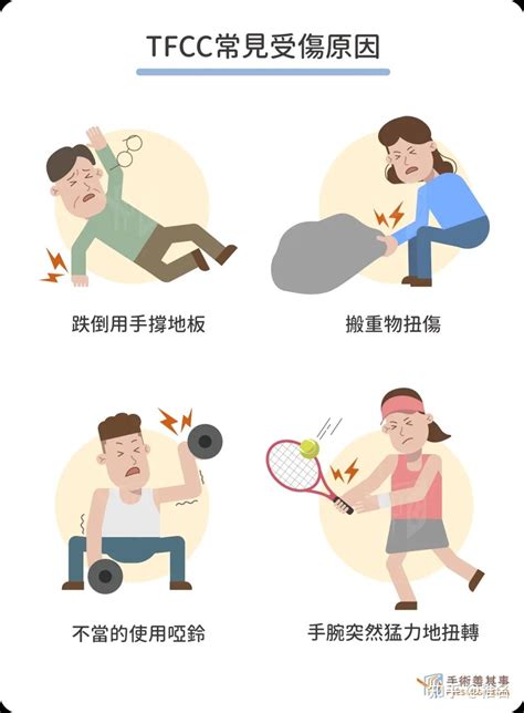 Tfcc 损伤 保守治疗篇 知乎