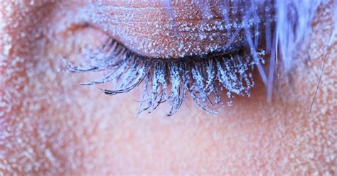 Frostbite Lips Symptoms