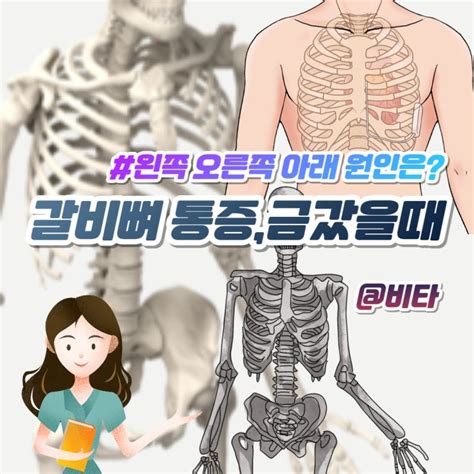 갈비뼈 통증 원인 왼쪽 오른쪽 아래 금갔을때 골절 증상 치료 네이버 블로그
