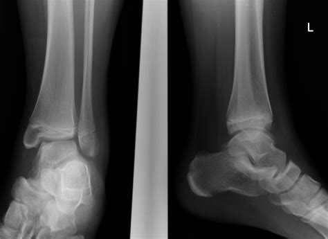 Test Yourself Regular Sets Set 15 Emergency Department Radiology Courses