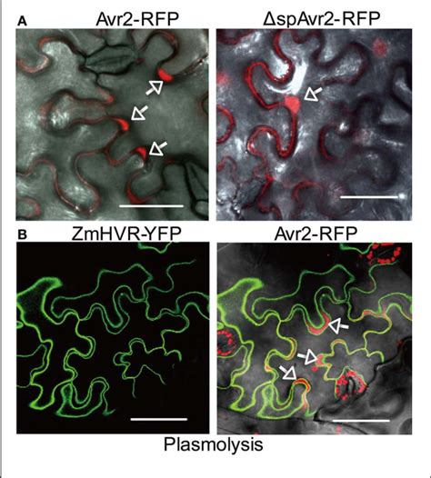 Figure 1 From A Nuclear Localization For Avr2 From Fusarium Oxysporum