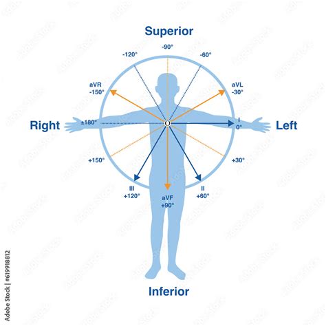 In The Frontal Lead System The Lead Axes Of The 6 Limb Leads Form A In The Frontal Lead System The Lead Axes Of The 6 Limb Leads Form A