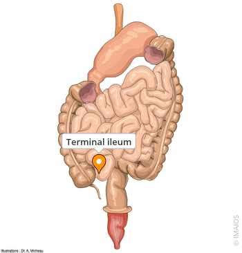 Terminal Ileum E Anatomy Imaios